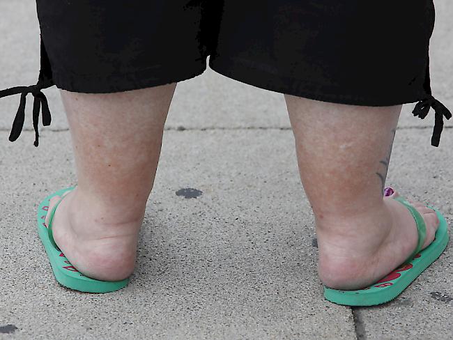 Rund 640 Millionen Menschen weltweit sind übergewichtig | 1815.ch